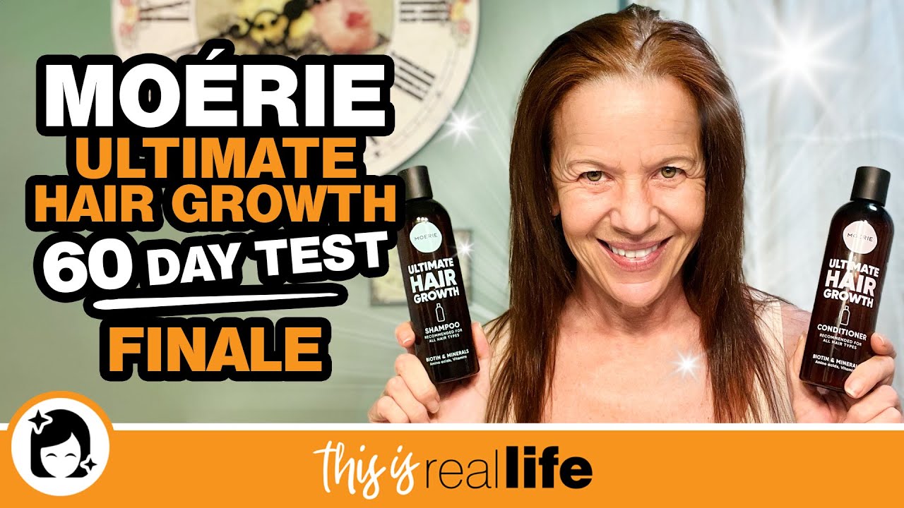 Moérie Ultimate Hair Growth 60 Day Test: Finale - THIS IS REAL LIFE ...