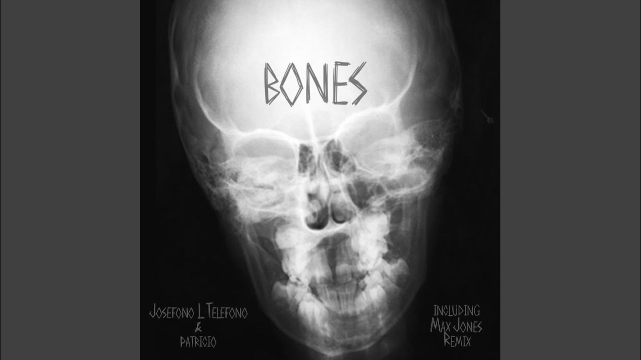 Bones (Max Jones Remix) - YouTube