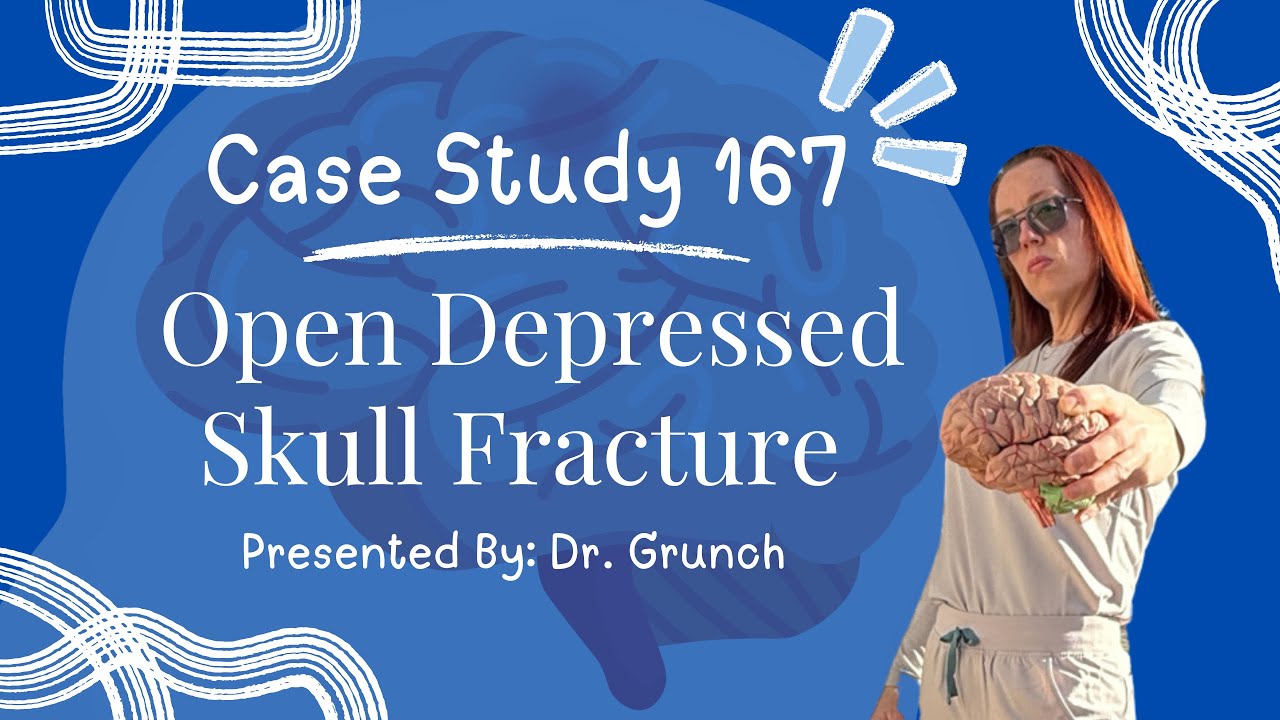 𝐂𝐚𝐬𝐞 𝐬𝐭𝐮𝐝𝐲 𝟏𝟔𝟕: 𝘖𝘱𝘦𝘯 𝘥𝘦𝘱𝘳𝘦𝘴𝘴𝘦𝘥 𝘴𝘬𝘶𝘭𝘭 𝘧𝘳𝘢𝘤𝘵𝘶𝘳𝘦⁣ - YouTube