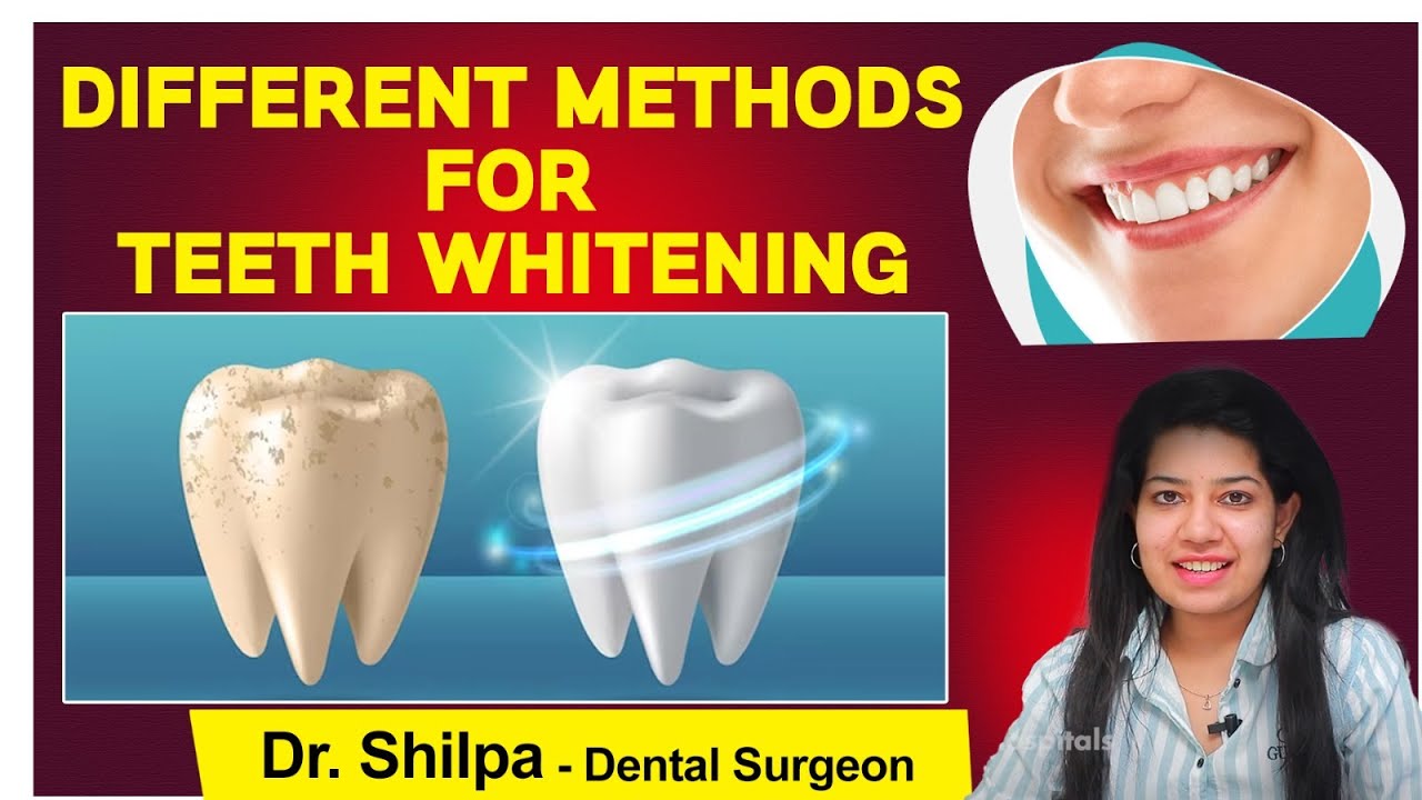 How to Get Rid of Yellow Teeth | Best Way to Teeth Whitening | dental ...