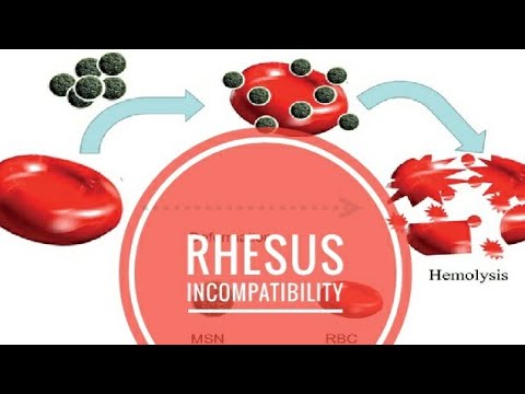 Rh Factor (Transfusion and Incompatibility) - YouTube