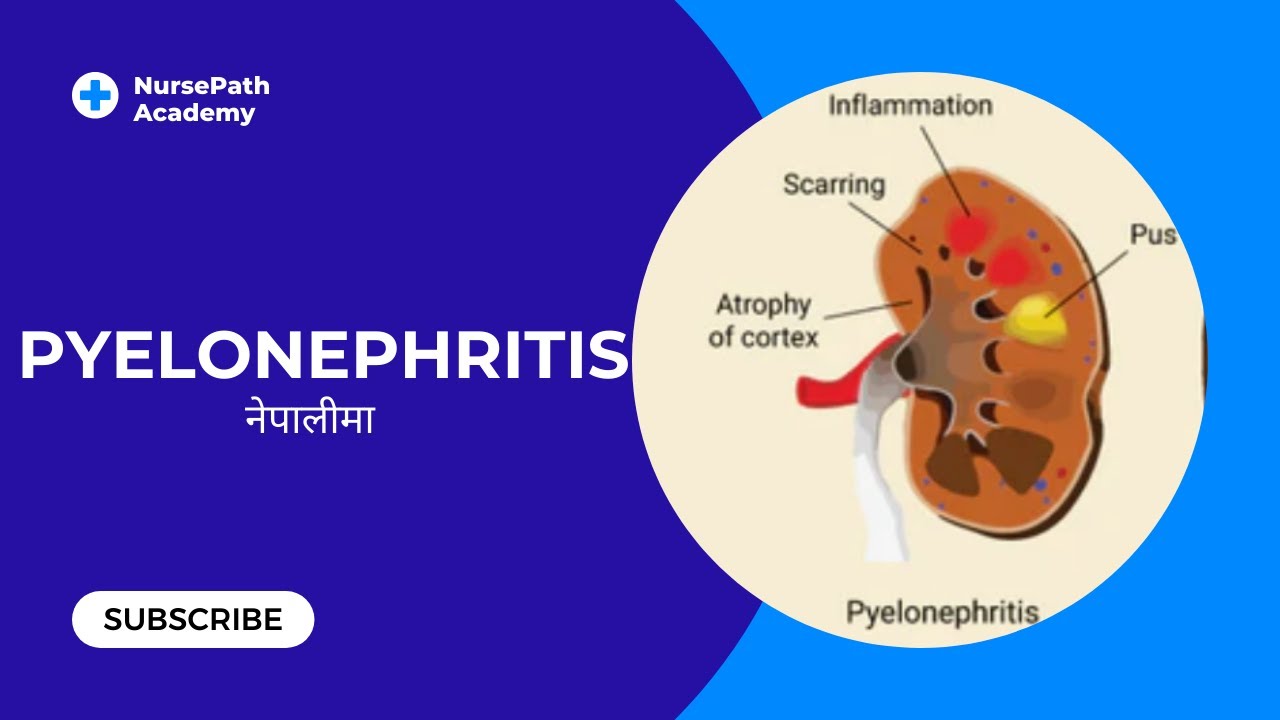 Pyelonephritis Explained | Causes, Symptoms & Treatment | Nursing ...