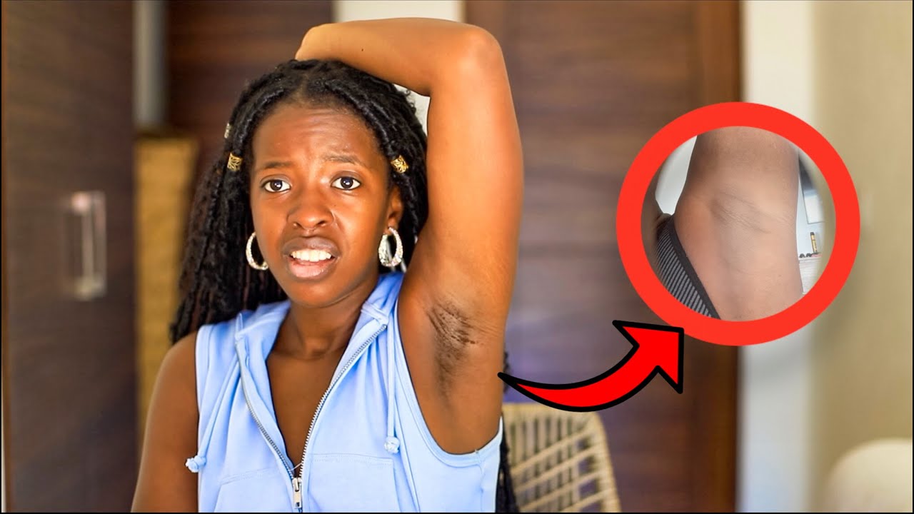 How I lighten My Armpits & got rid of ARMPIT ODOR INSTANTLY - YouTube