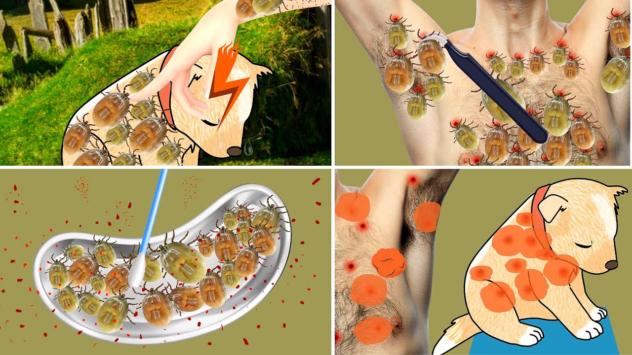 ASMR Crazy tick infestation 🔥 Ticks Removal | Animation NO MUSIC - YouTube
