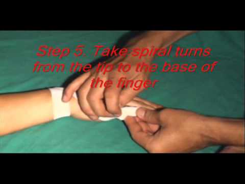 Finger tip Recurrent Bandage - YouTube