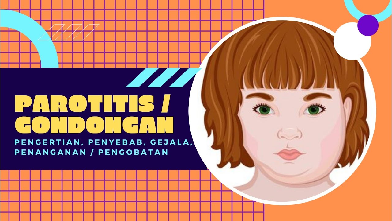 T1 kelompok 1 - Parotitis - YouTube