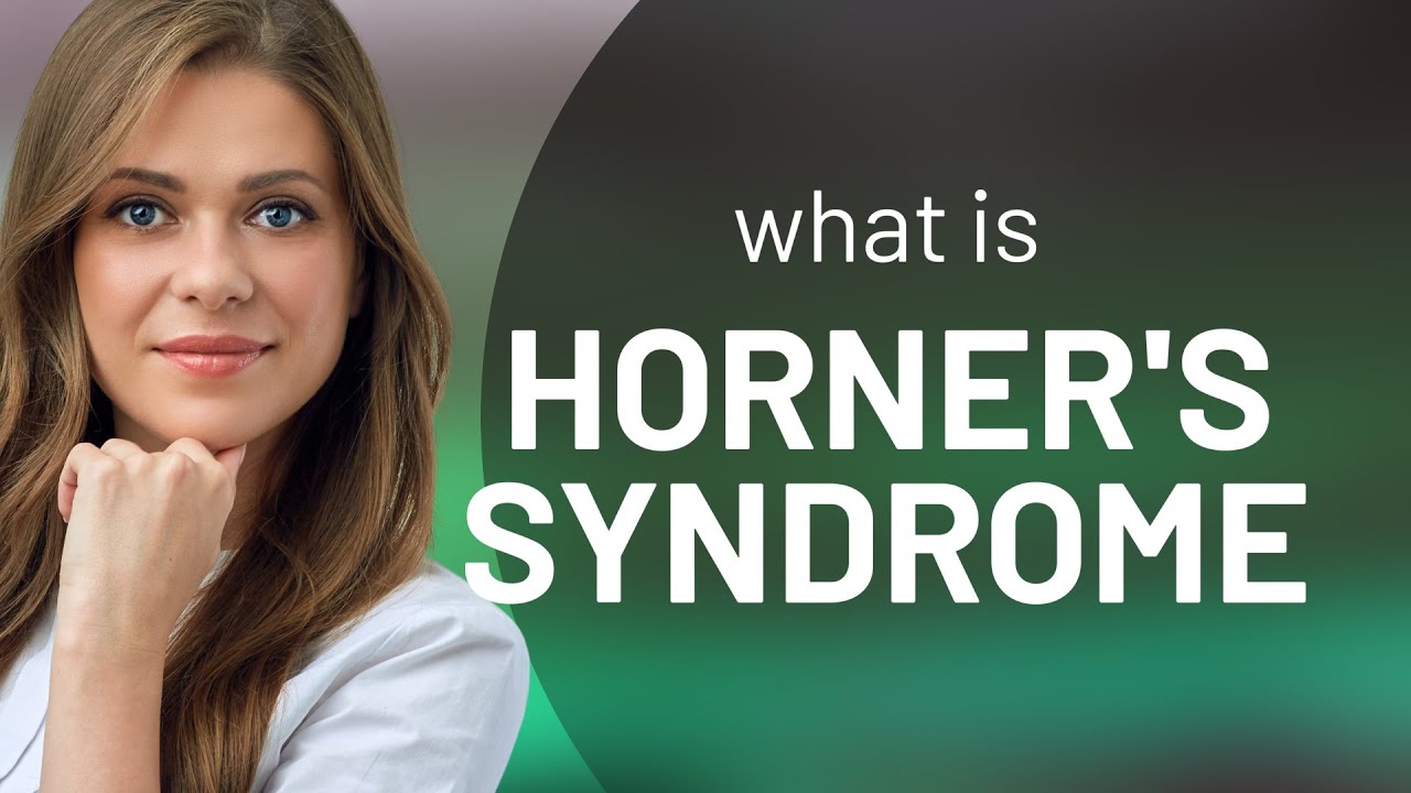 Horner's syndrome | meaning of HORNER'S SYNDROME - YouTube