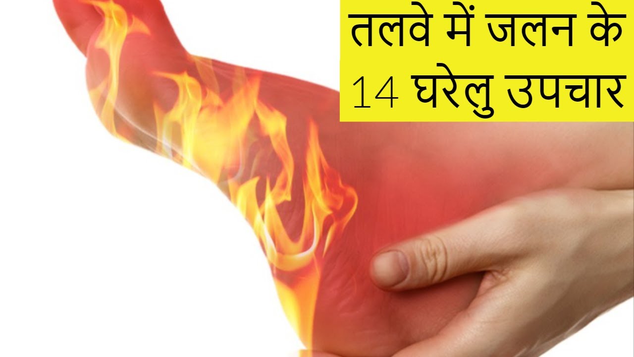 Talve Me Jaln ke karn Aur Upaye| तलवे में जलन के करण औए घरेलु उपाय |पैर ...