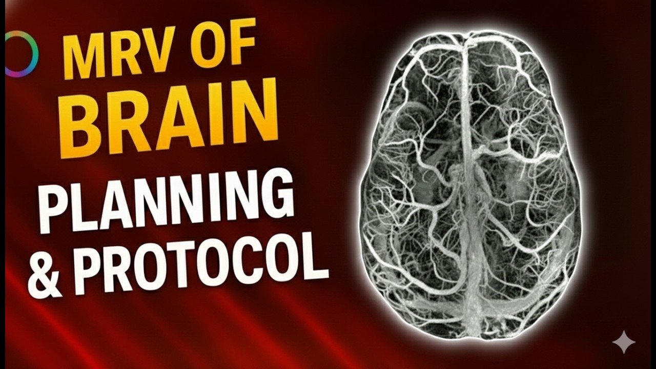 How to Perform MRI Brain with MRV | Complete Protocol Explained - YouTube