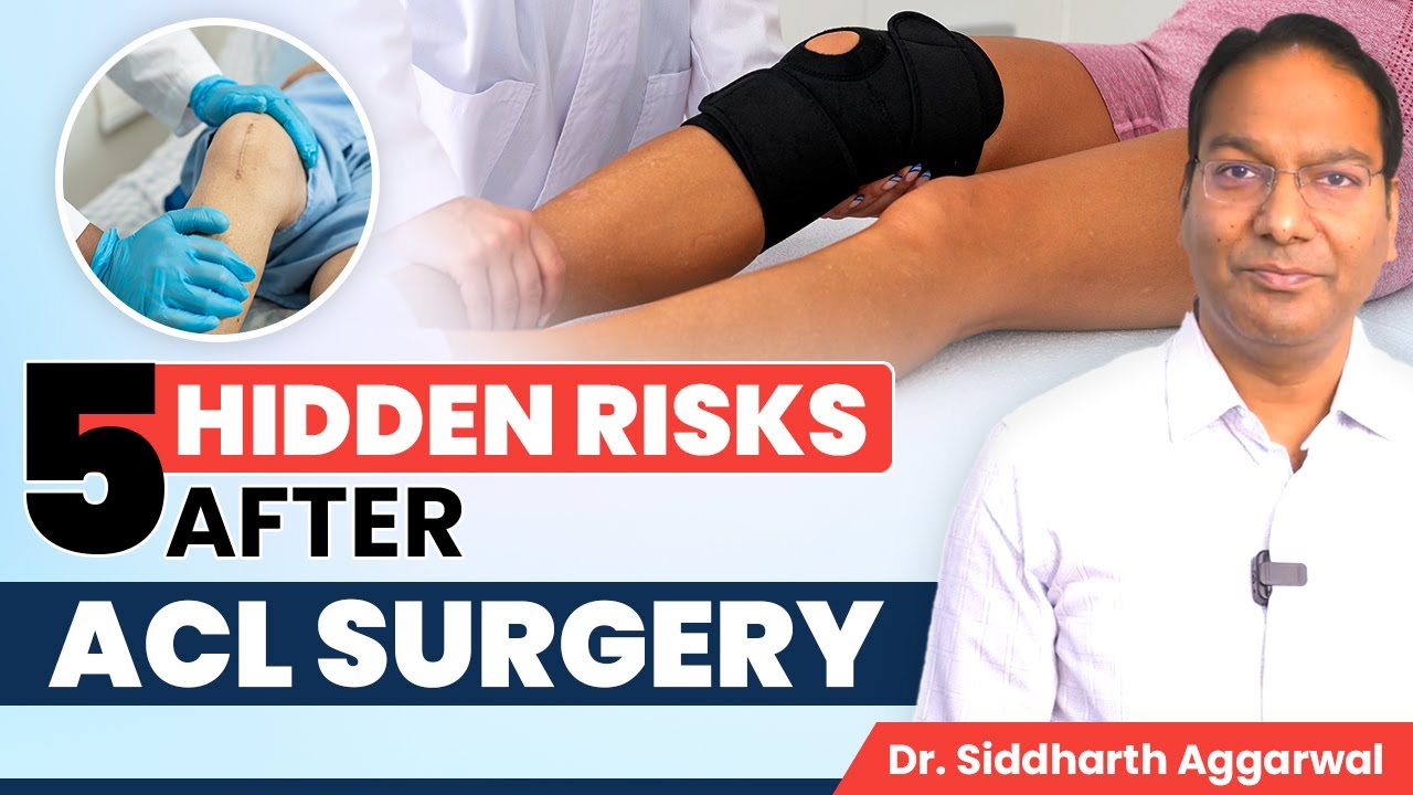 5 Hidden Risks After ACL Surgery | ACL Surgery Recovery | Dr Siddharth ...