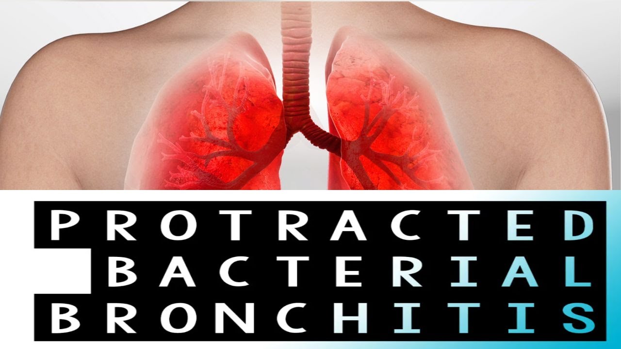 PROTRACTED BACTERIAL BRONCHITIS - YouTube