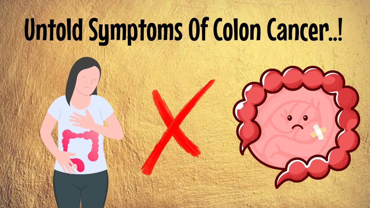 Colon Cancer - Symptoms, Prevention, Cure which requires urgent ...