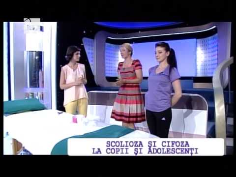 Scolioza si Cifoza la copii si adolescenti - Fiziolife - dr. Ana Maria ...