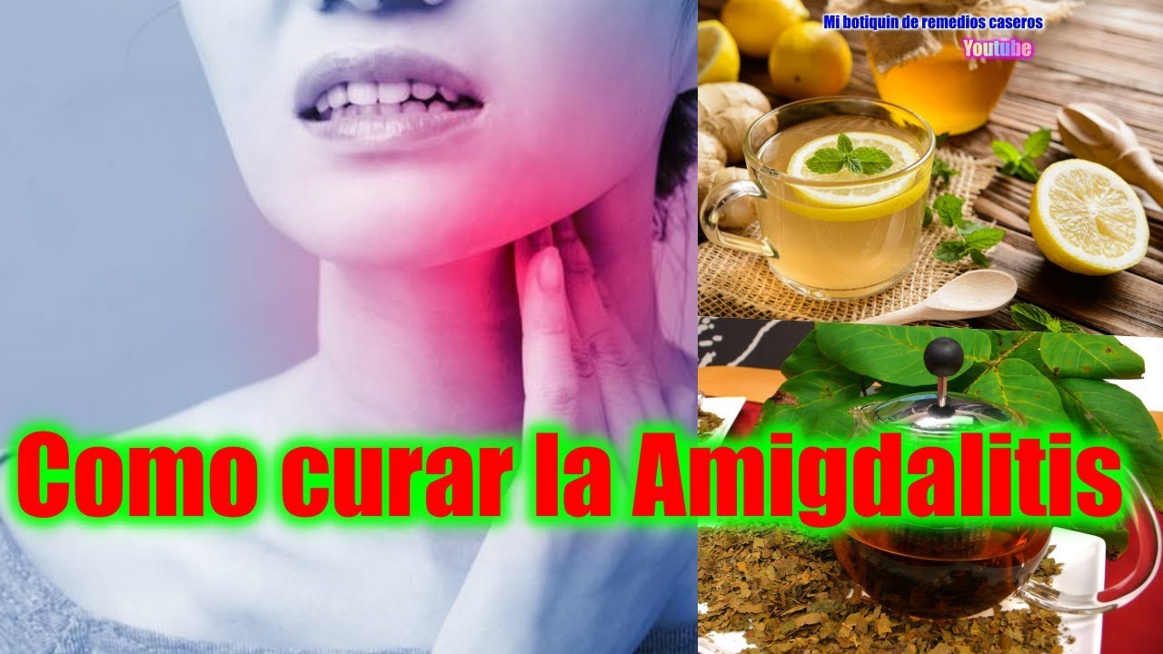 Cura la Amigdalitis o Anginas con estos sencillos pasos. - YouTube