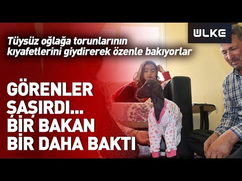 Gören Şaşırdı... Bu Oğlak Tüysüz Doğdu, Bebek Gibi Bakılıyor!