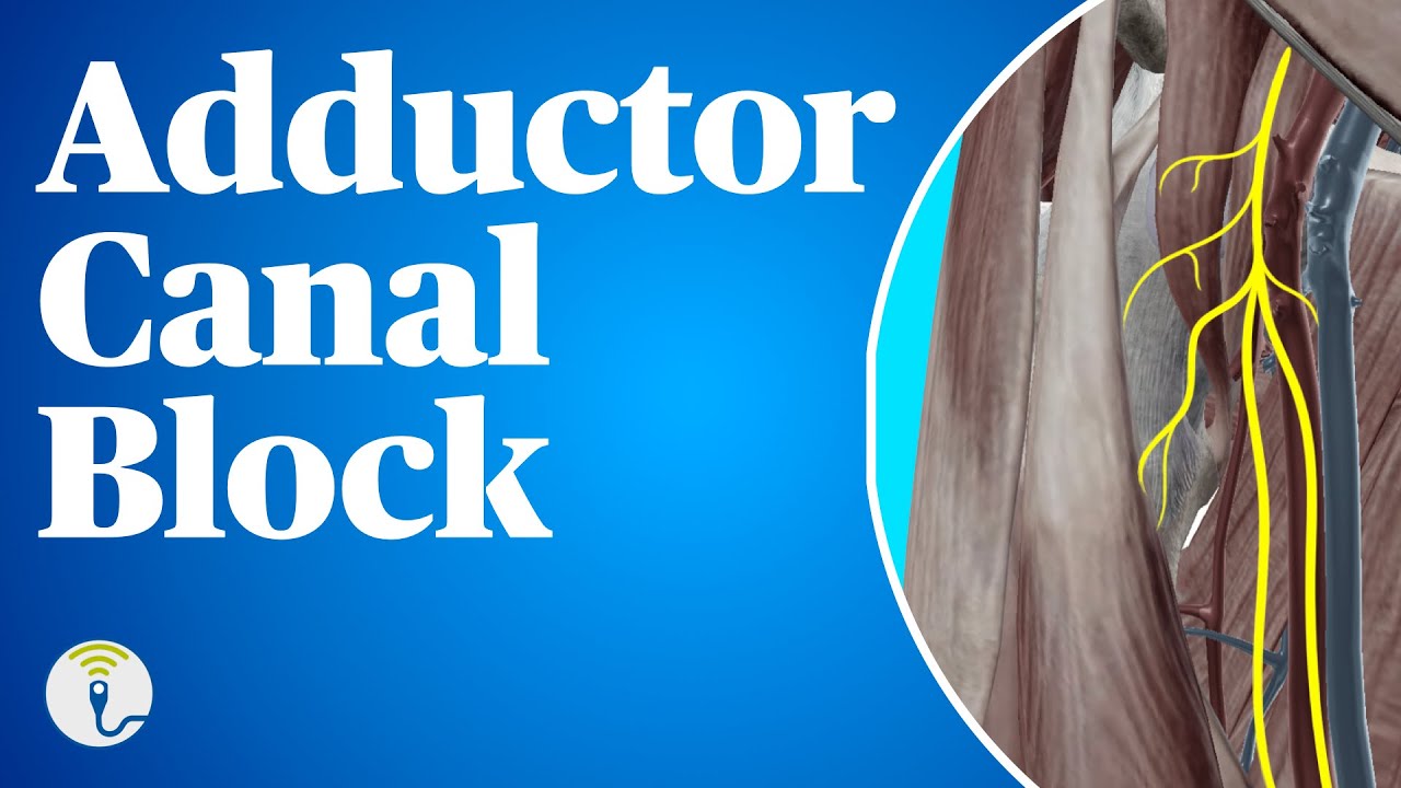 Adductor Canal Block - YouTube