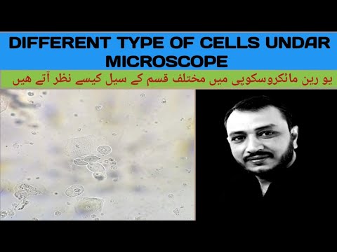 different type of cells under microscope |pus cells nonmotile sperm and ...