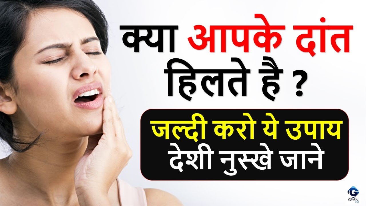 मेरे दांत हिलते है क्या करू? | Dant ke hilna ka ilaj | loose teeth ...
