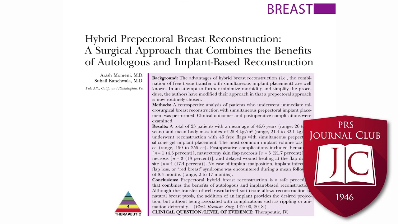 Hybrid Pre-pectoral Breast Reconstruction: #PRSJournalClub Podcast ...