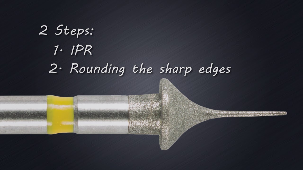 Strauss Diamond 0.3mm Interproximal Reduction IPR - YouTube