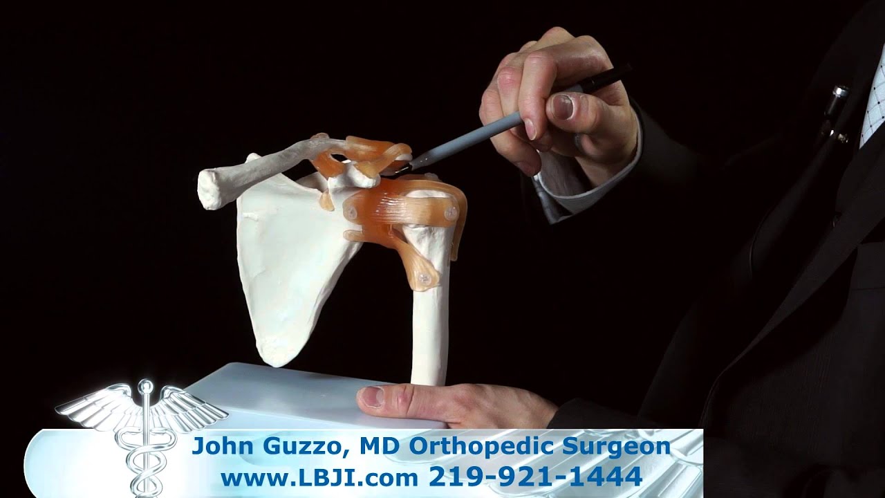 Orthopedic Surgeon, Schererville, IN Dr. John Guzzo Explains SLAP ...