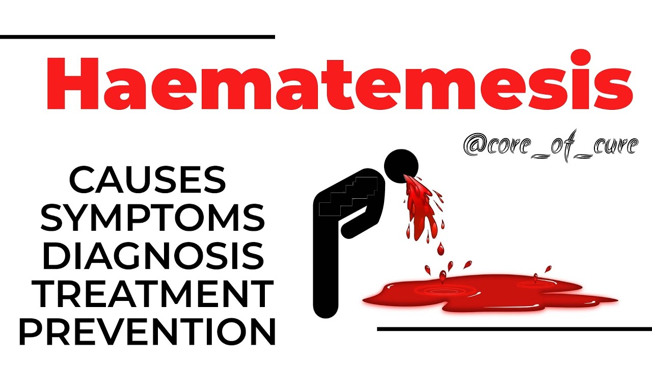 HAEMATEMESIS || CAUSES || SYMPTOMS || DIAGNOSIS || TREATMENT ...