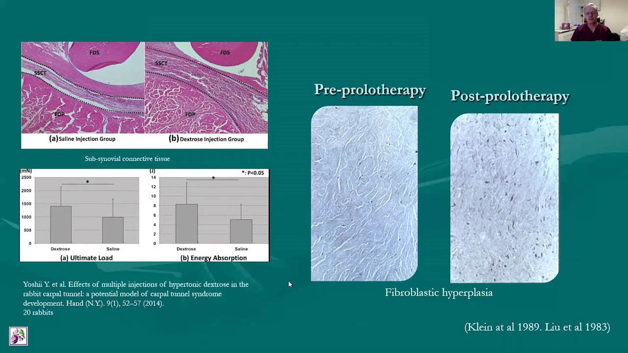 Injections in SEM and MSK - YouTube