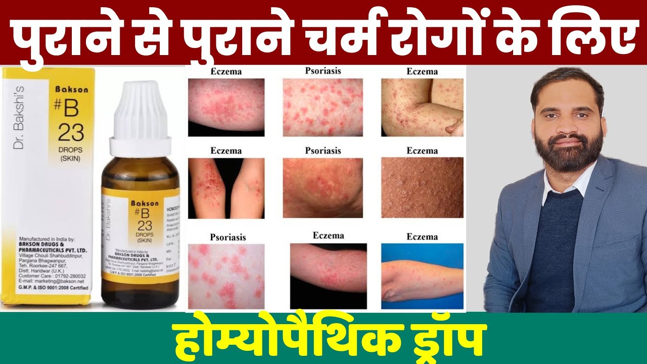 Bakson b23 drops uses in hindi | B23 skin drops - YouTube