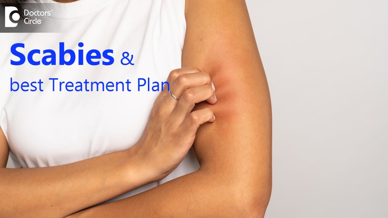 Itching & rashes on Skin- Is it Scabies?Symptoms, Causes & Treatment ...