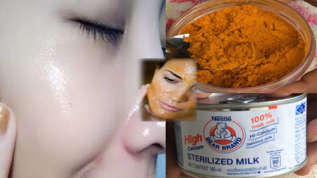 Get Rid Of Acne ,Bruises ,Using Only Milk , Turmeric Powder /turmeric ...