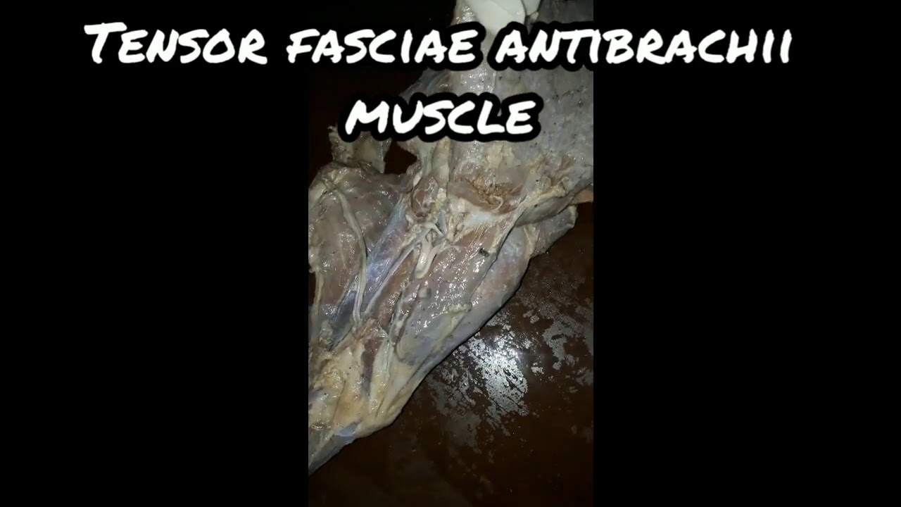 Muscles of forelimb of dog medial side brachial region Veterinary ...