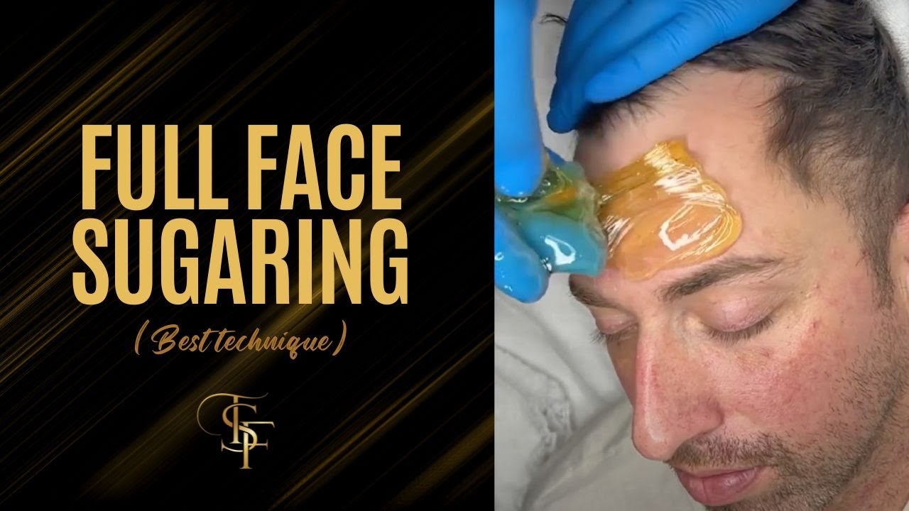 The BEST Sugaring Technique For A Man's Face | Man's Face Sugaring ...