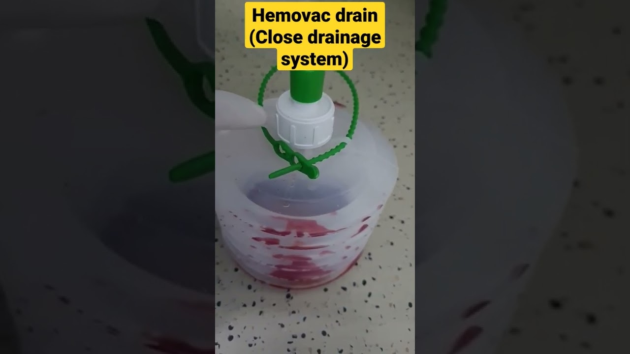 Hemovac Drain