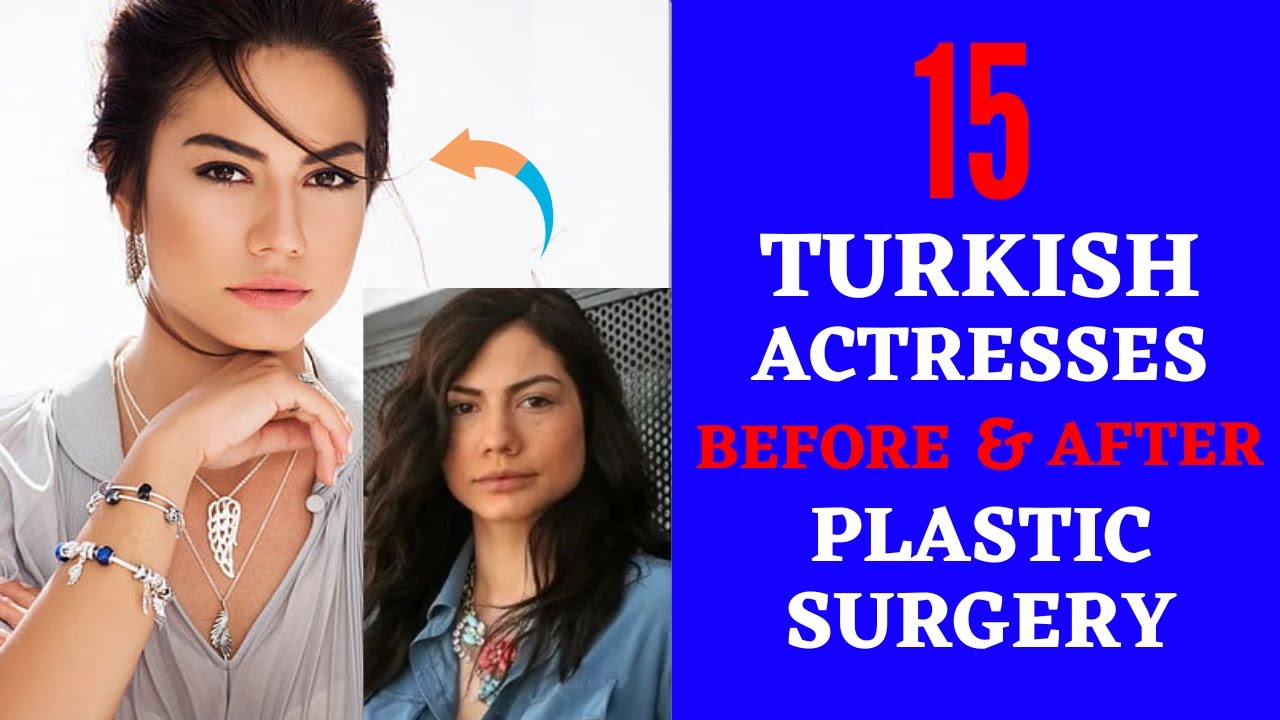 15 TURKISH ACTRESSES BEFORE & AFTER PLASTIC SURGERY! - YouTube