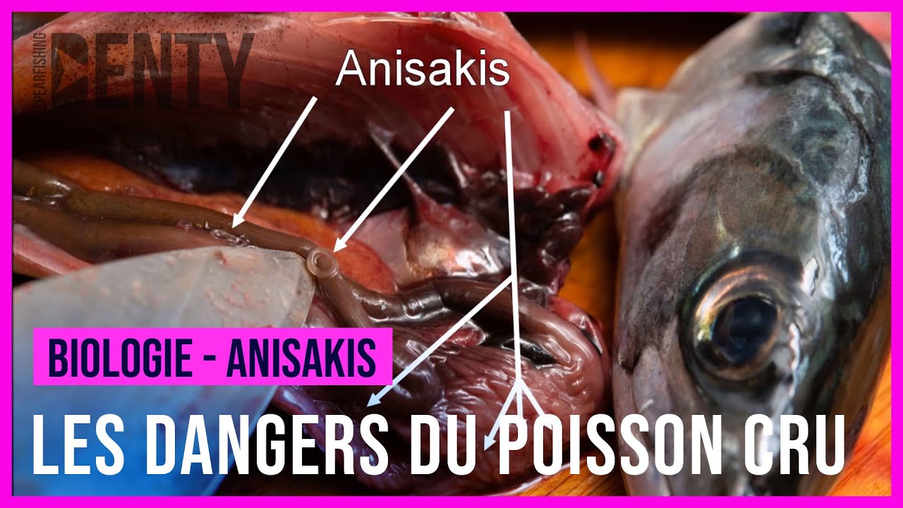 ANISAKIASE, LES DANGERS DU POISSON CRU - Parasite Anisakis et ténia ...