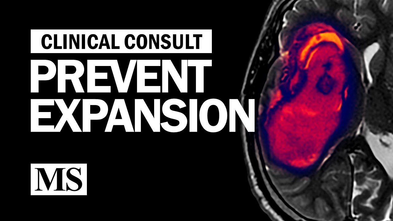 Clinical Consult: Prevent Expansion - YouTube