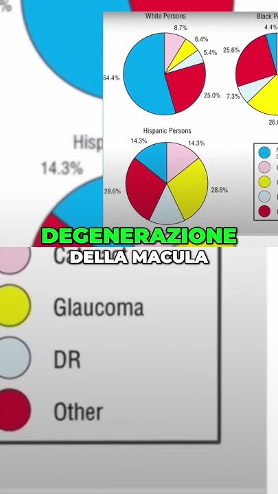 Salute Oculare: Etnia e Rischi Specifici [Studio Americano] - YouTube