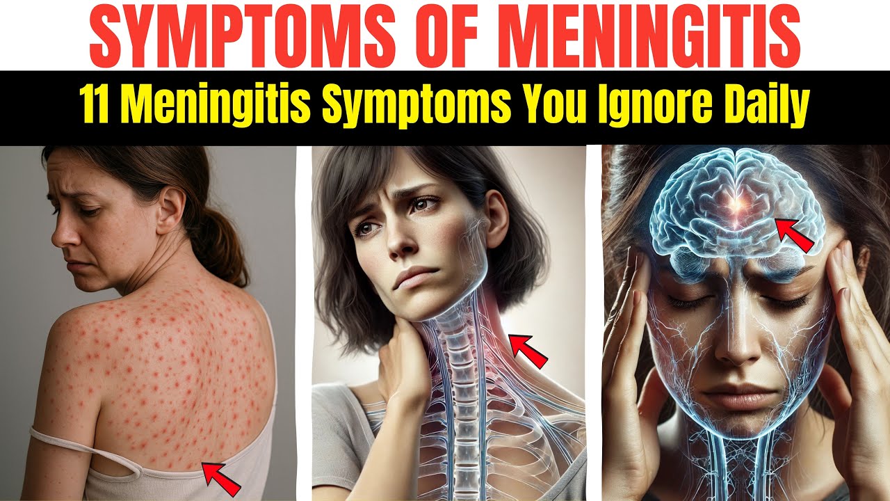 11 DAILY Symptoms of Meningitis (Daily You Ignore) | Early Signs Of ...