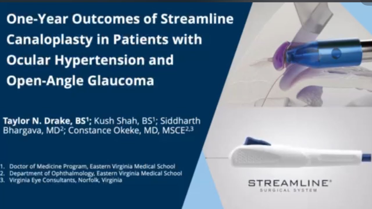 Streamline Canaloplasty: 1-Year Study Reveals Key Outcomes in Glaucoma ...