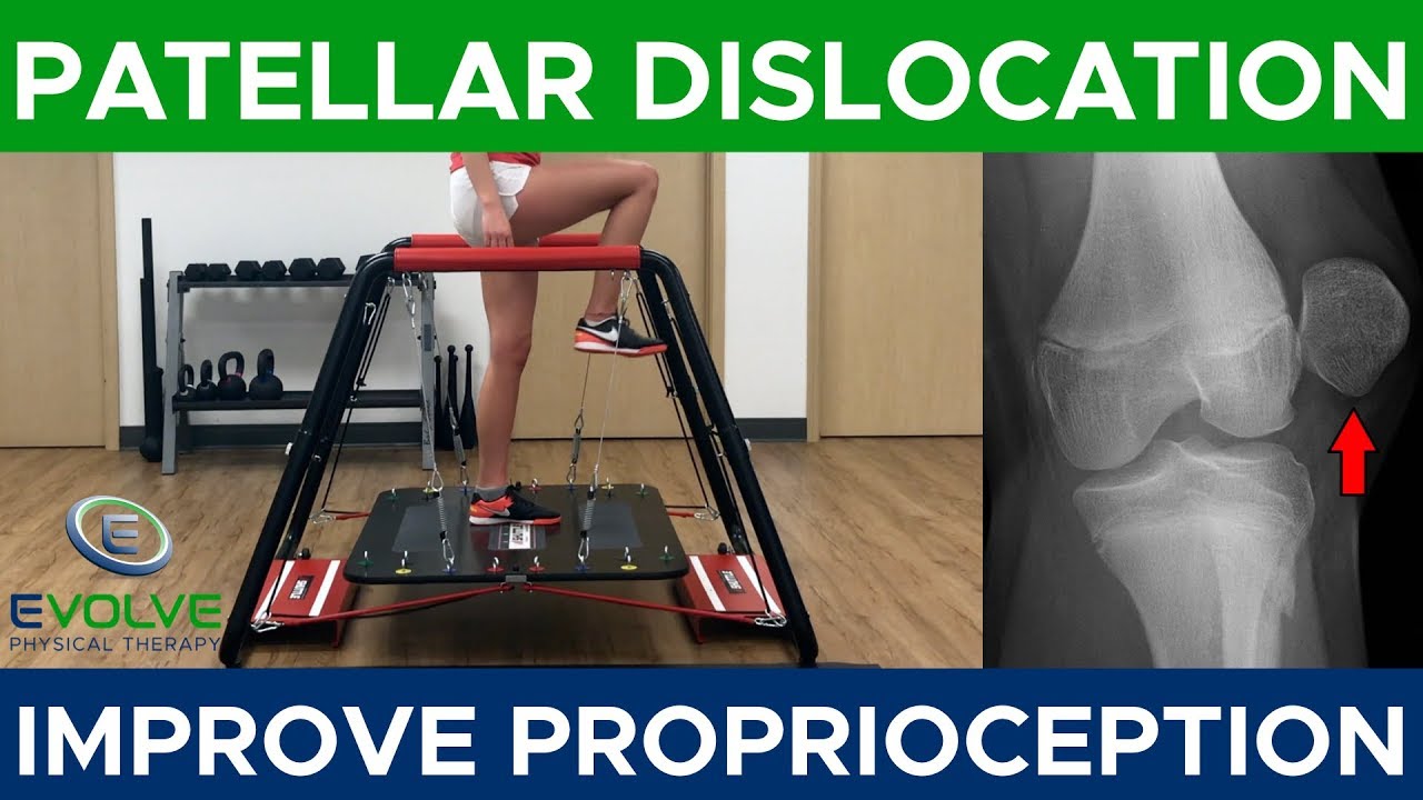 Patellar Dislocation | Improving Dynamic Knee Stability | Part 2 - YouTube