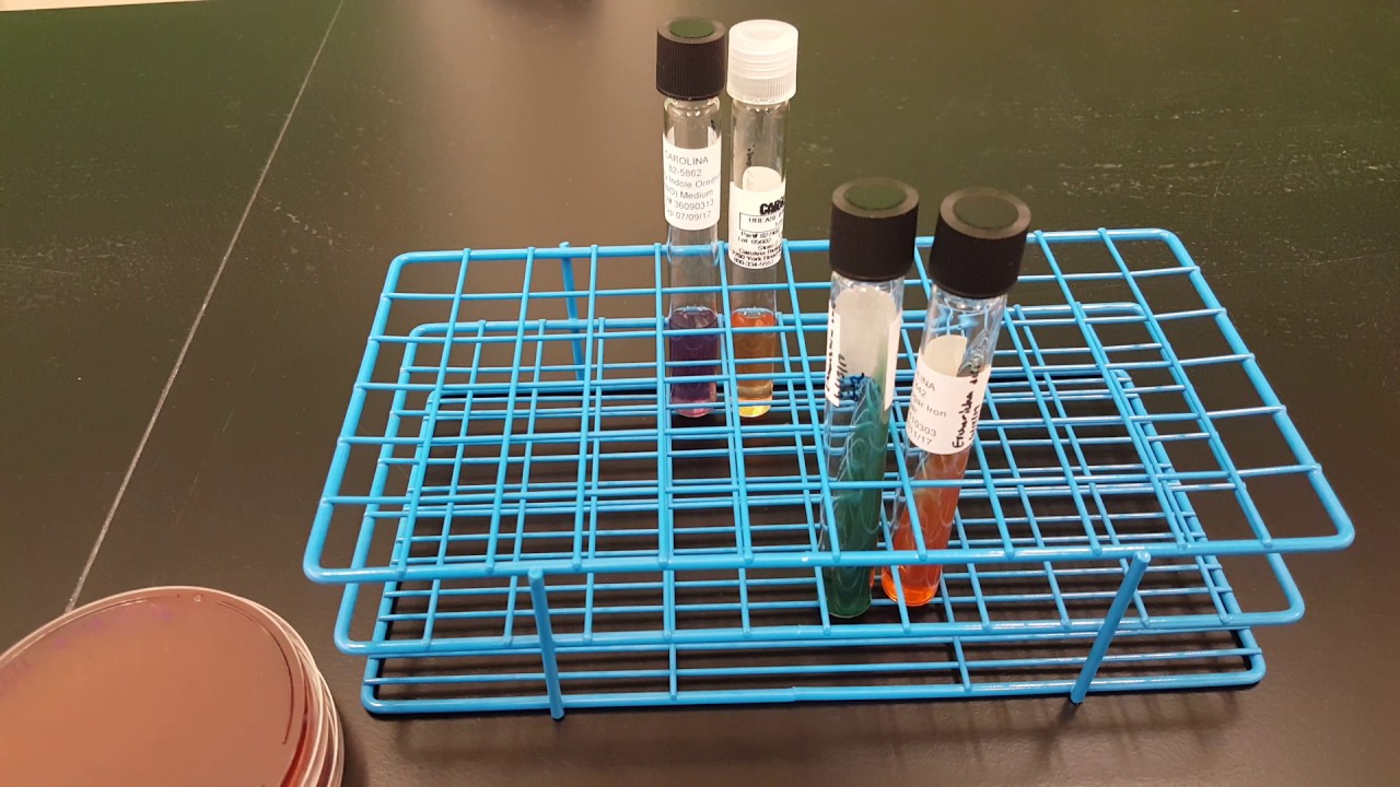 Microbiology: Inoculation of GNR biochemicals with Escherichia coli ...