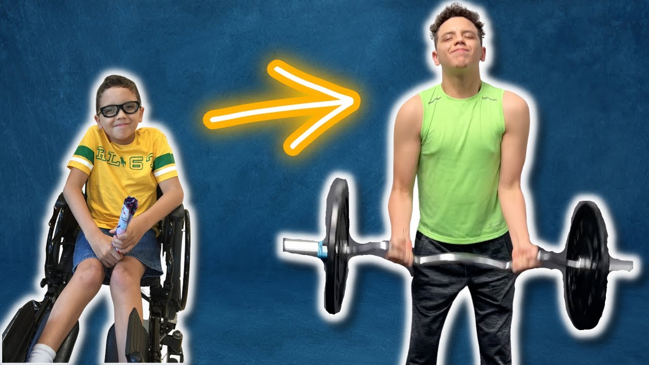 How I Fight My Handicap | Arthrogryposis Multiplex Congenita | My Story ...