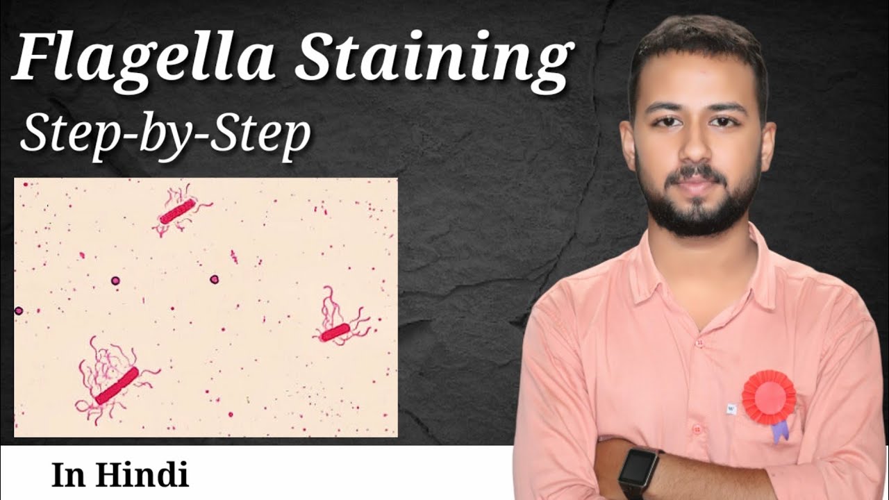 Flagella staining by leifson method | flagella staining procedure | flagella staining ...