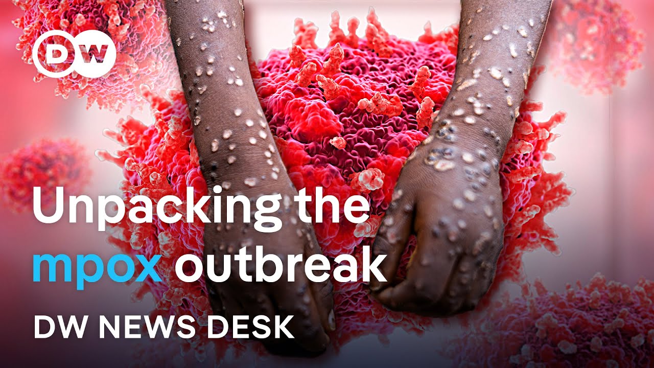 How dangerous is the mpox clade Ib public health emergency? | News Desk ...