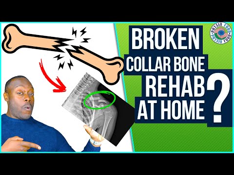 How To Get Back Into Exercise After Broken Collarbone