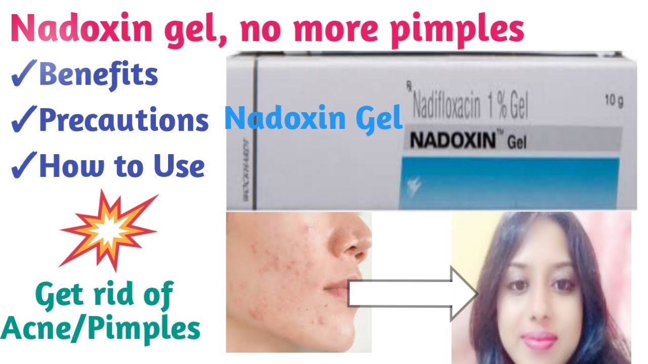 Nadoxin gel review, no more pimples/ Acne. Honest review on Nadoxin gel ...
