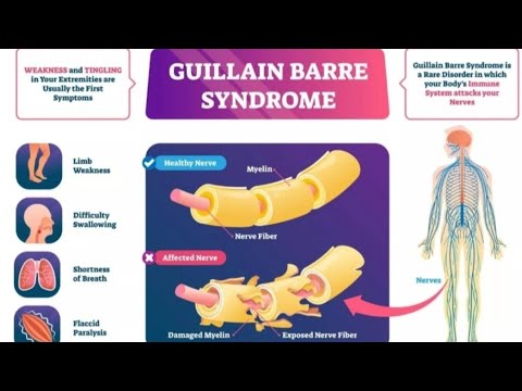GUILLAIN BARRE SYNDROME || CAUSES ||PATHOPHYSIOLOGY||SYMPTOMS ...