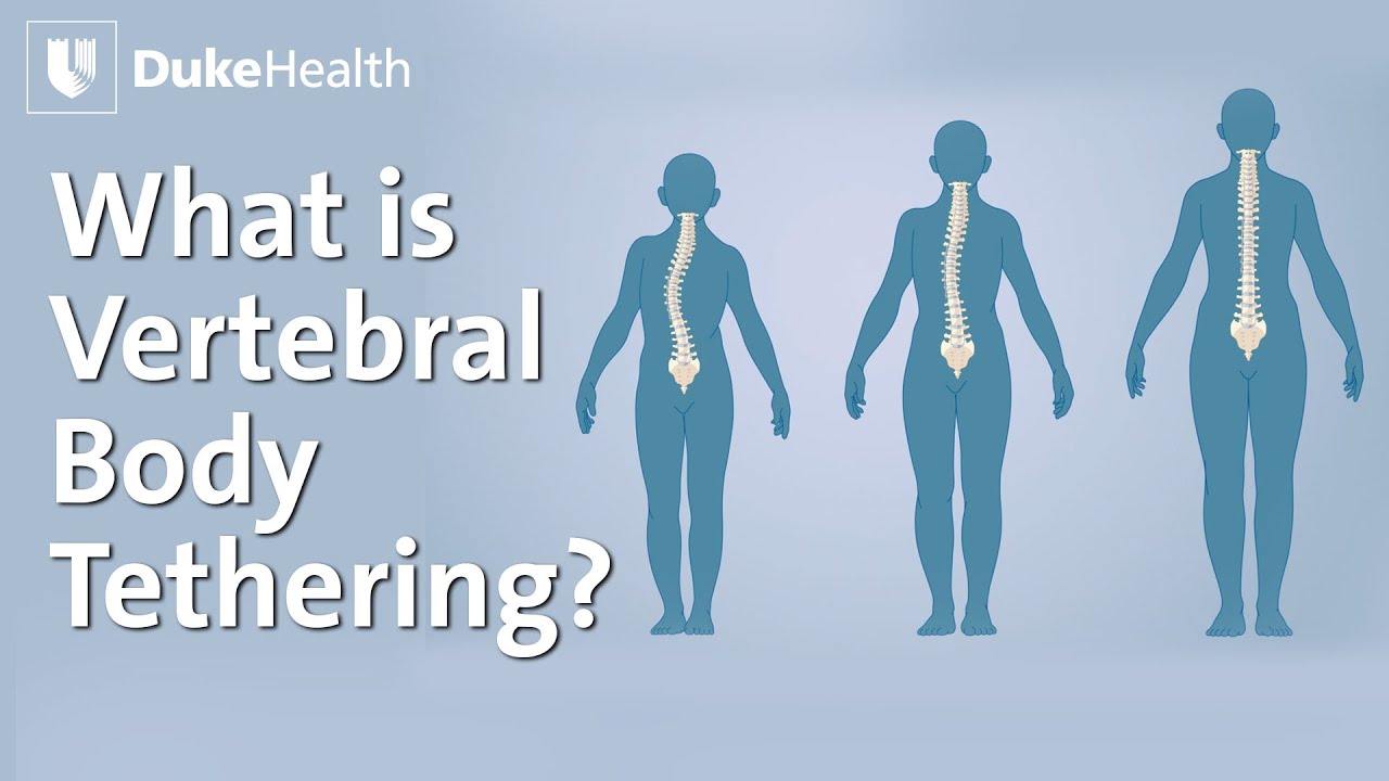 What is Vertebral Body Tethering? | Duke Health - YouTube