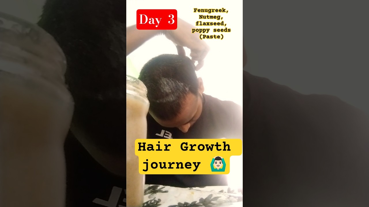 Day 3 Hair Growth journey 🙆🏻‍♂️. - YouTube