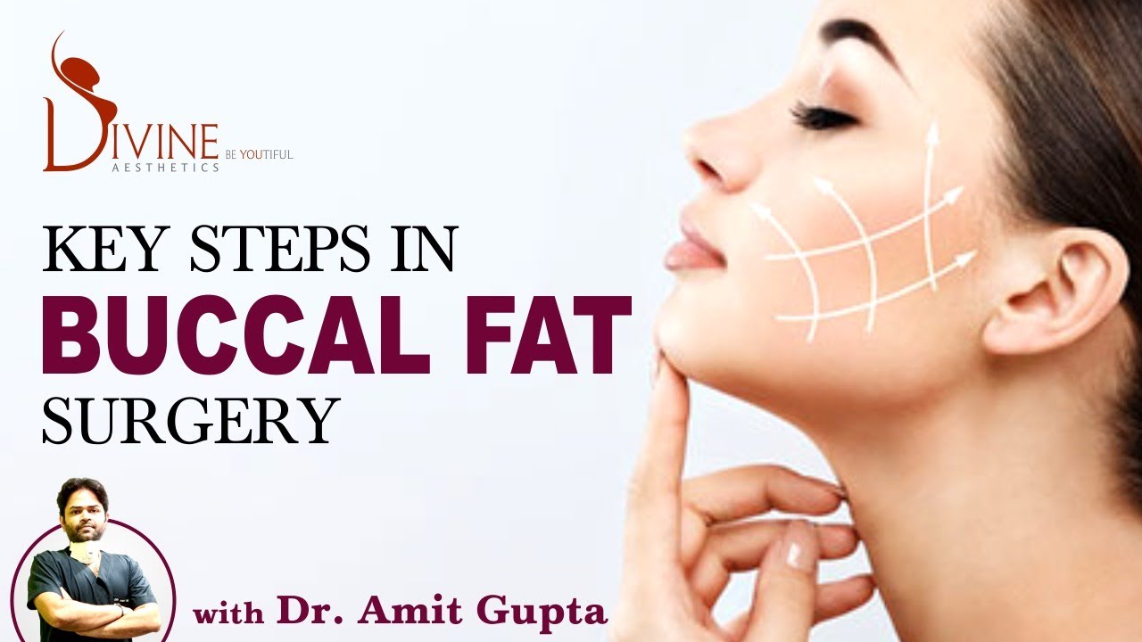 Key Steps in Buccal Fat Surgery - See with Dr Amit - YouTube